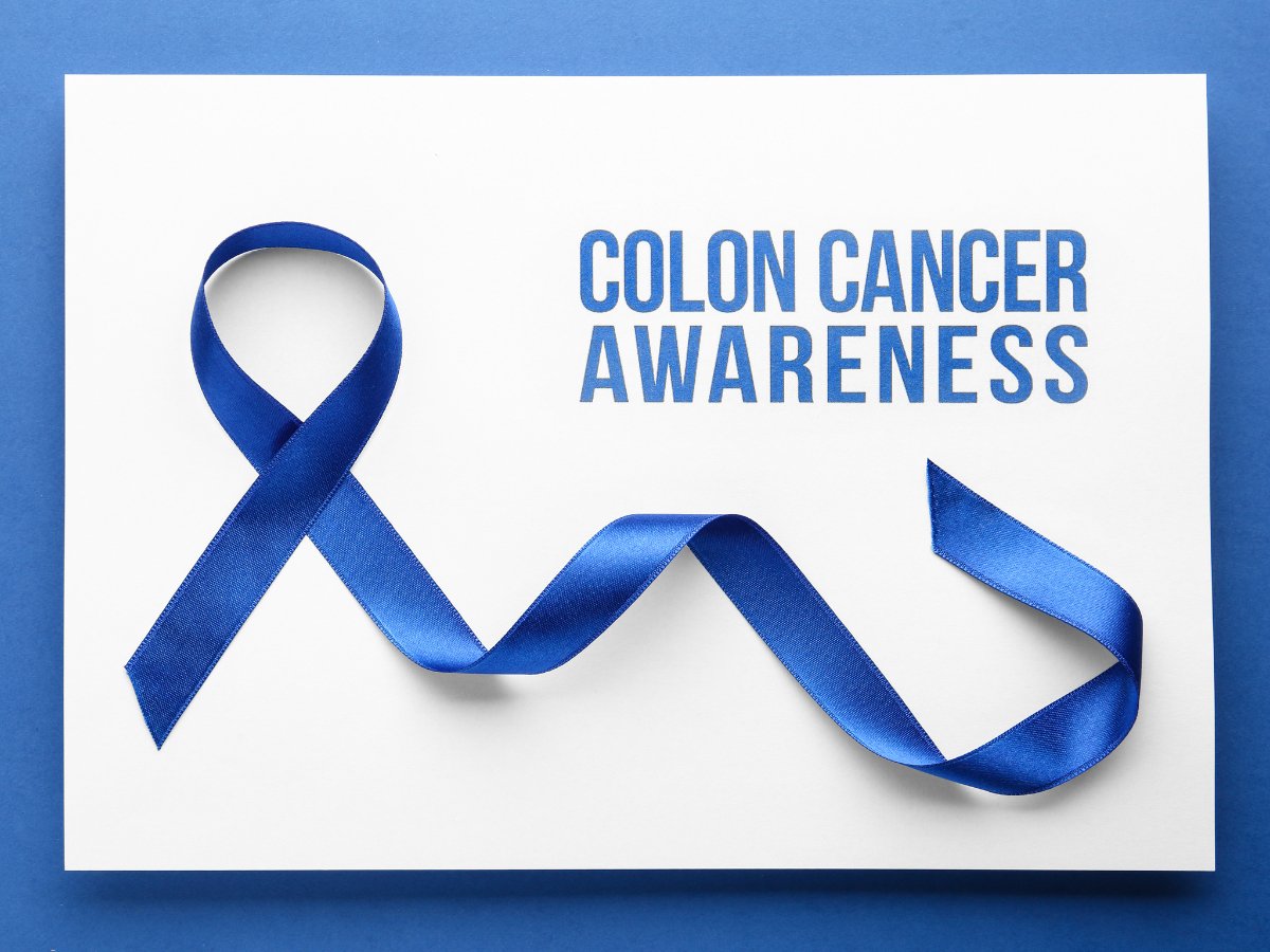 Understanding Colon Cancer: Awareness, Prevention, and Treatment ...